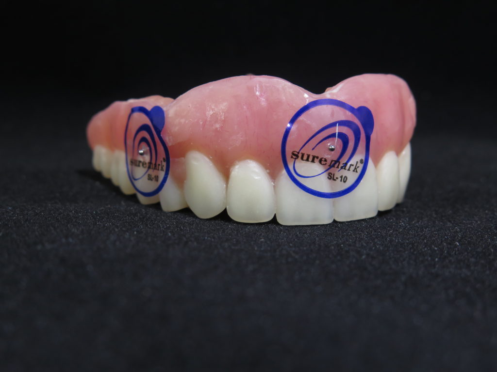 Fully Edentulous CBCT Scan: Dual Scan Protocol of Maxilla - Implant ...