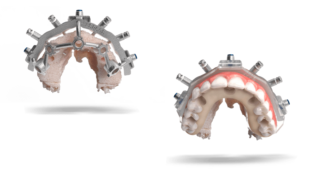 CHROME GuidedSMILE™ Guide Package - Implant Concierge